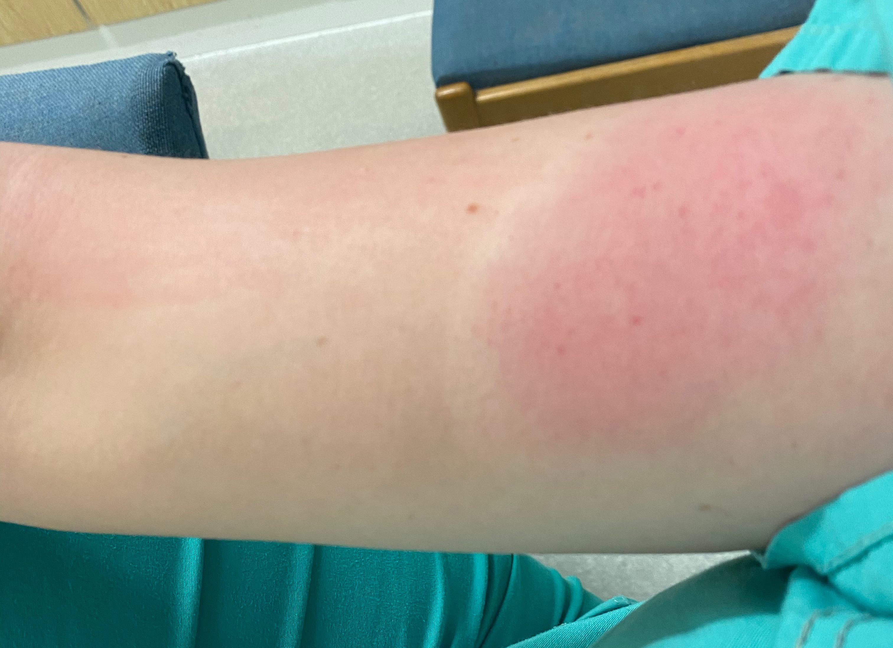 The Heat Is On – Mortuary Gem